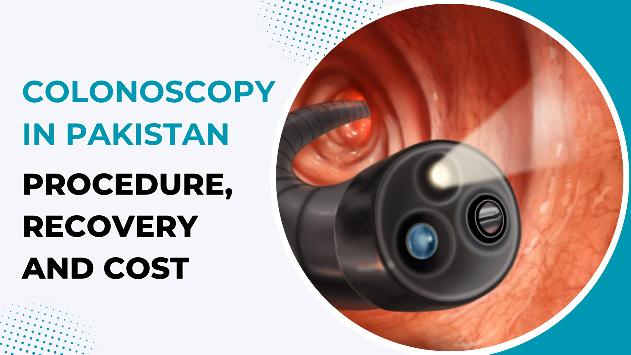 Colonoscopy In Pakistan: Procedure, Recovery And Cost - IGA